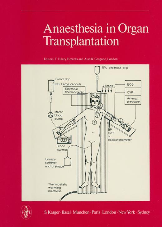 Death | Anaesthesia in Organ Transplantation | Books Gateway | Karger ...