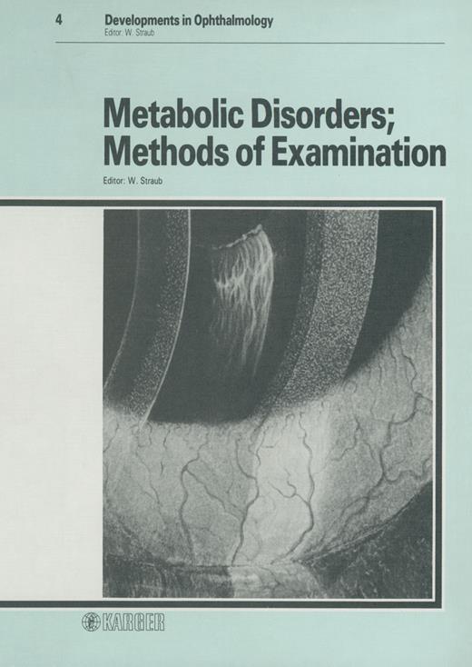 Metabolic Disorders and Corneal Changes | Metabolic Disorders: Methods ...