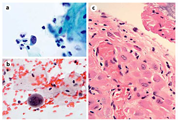 The Pap Test and Bethesda 2014 | Acta Cytologica | Karger Publishers