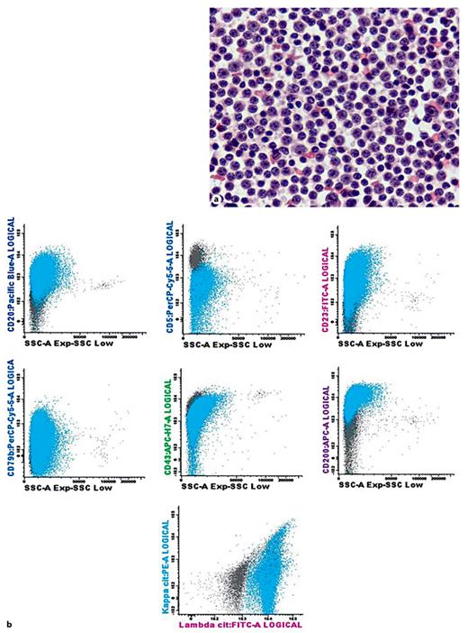A Basic Approach to Lymph Node and Flow Cytometry Fine-Needle Cytology ...