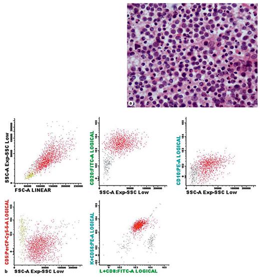 A Basic Approach to Lymph Node and Flow Cytometry Fine-Needle Cytology ...