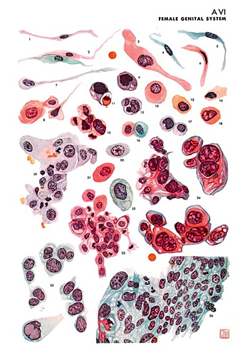 Inception and Development of the Papanicolaou Stain Method | Acta ...