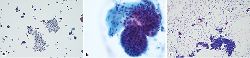 Head and Neck Cystic Lesions: A Cytology Review of Common and Uncommon ...