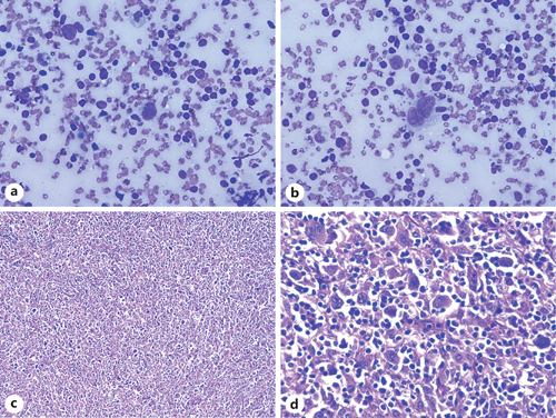The Application of the Proposed Sydney System for Reporting Lymph Node ...