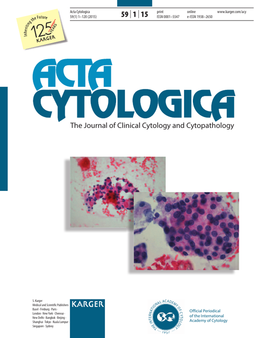 Fine-Needle Aspiration Cytology of Disseminated Kaposi Sarcoma of the Bone in an AIDS Patient ...