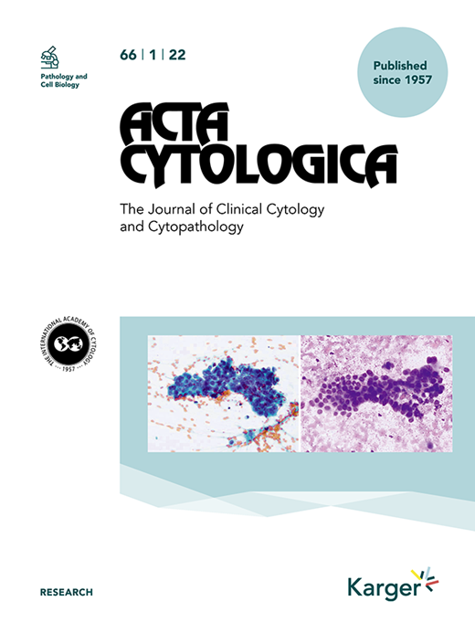 Application of Hans Algorithm for Subcategorization of Diffuse Large B ...