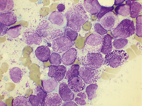 Morphological and Immunophenotypic Clues to the WHO Categories of Acute ...