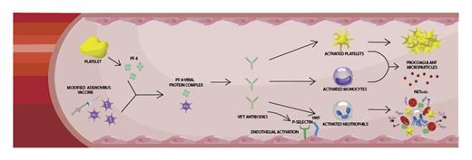 COVID-19 Coagulopathy: From Pathogenesis to Treatment | Acta ...