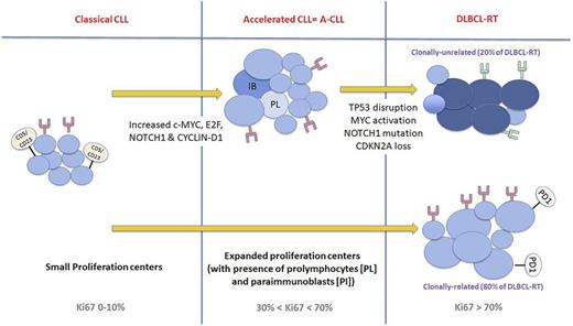 Accelerated Chronic Lymphocytic Leukemia and Richter Transformation in ...