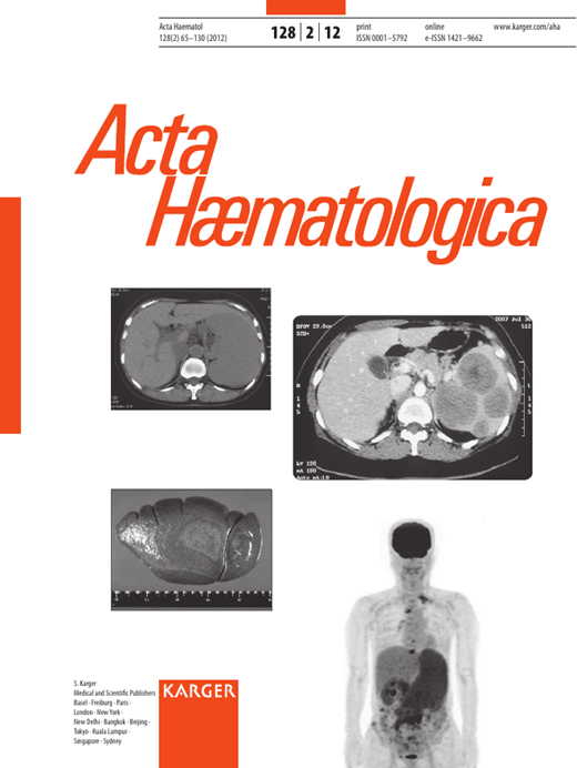 Acute Lymphoblastic Leukemia Expressing b3a2 (p210), e1a2 (p190), and ...