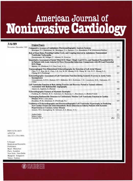 Quantitative Assessment of Serial ‘Mini ECG Maps’,Single Lead ECGs, and ...