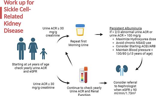 Sickle Cell Disease and CKD: An Update | American Journal of Nephrology ...