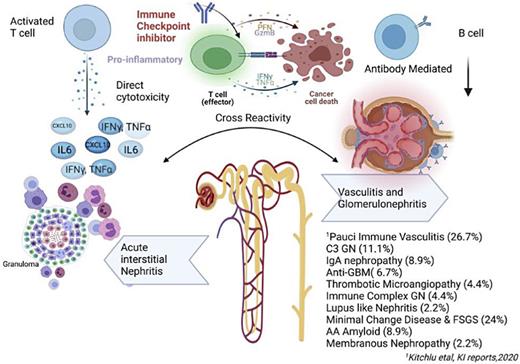 Immune Checkpoint Inhibitor-Related Acute Kidney Injury: Management and ...