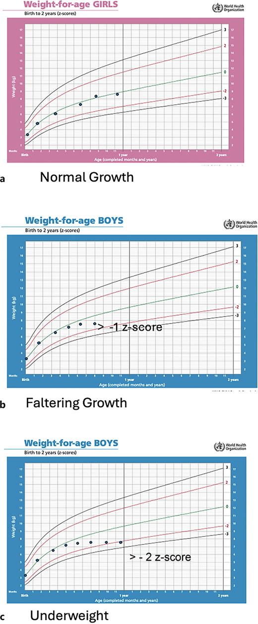 An Update on the Diagnosis and Management of Faltering Growth and Catch ...