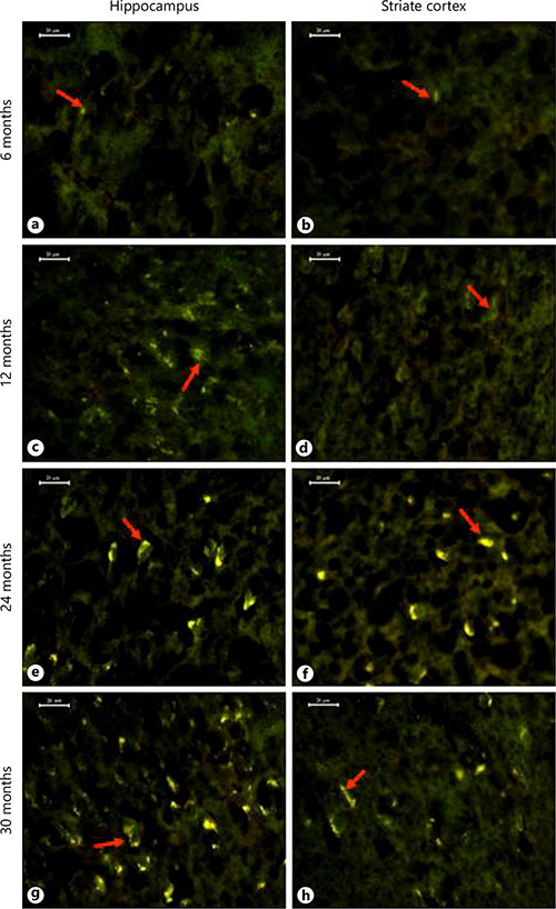 A Sequential Study of Age-Related Lipofuscin Accumulation in ...