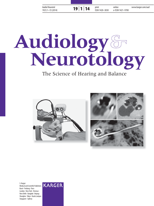 Alternative Fixation of an Active Middle Ear Implant at the Short Incus ...