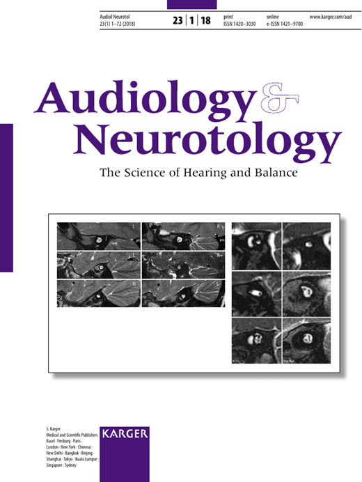 Trough-Shaped Audiograms Are Common in Patients with Acoustic Neuroma ...