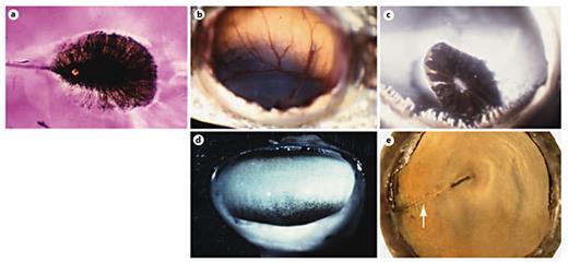 The Retinal Wholemount Technique: A Window to Understanding the Brain ...