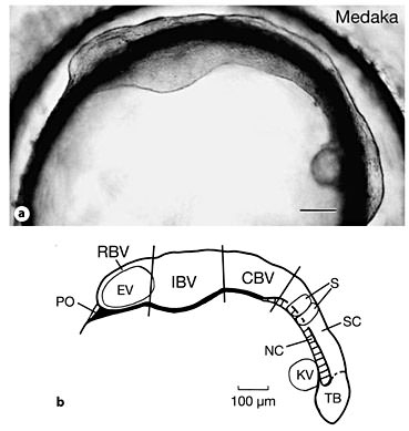 The Primary Brain Vesicles Revisited: Are the Three Primary Vesicles ...