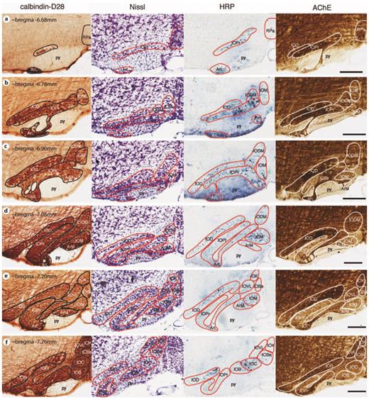 The Arcuate Nucleus of the C57BL/6J Mouse Hindbrain Is a Displaced Part ...