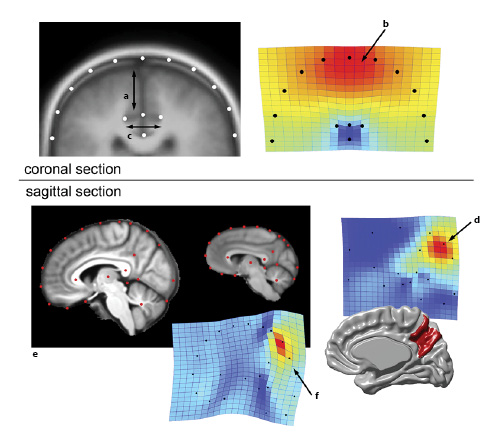Human Paleoneurology and the Evolution of the Parietal Cortex | Brain ...