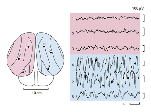 Evidence for Sleep in Sharks and Rays: Behavioural, Physiological, and ...