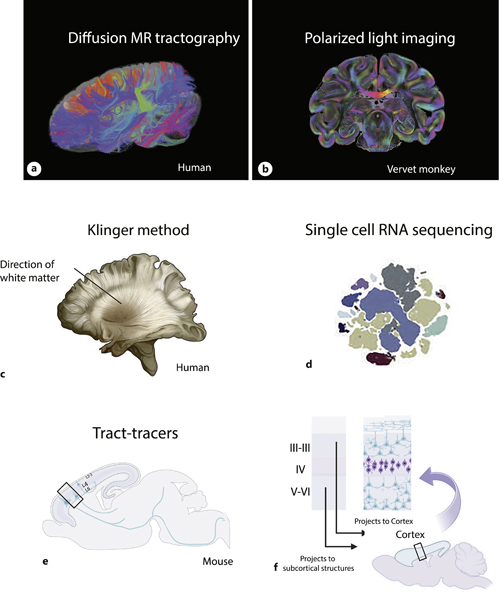 Mapping Human Brain Pathways: Challenges and Opportunities in the ...