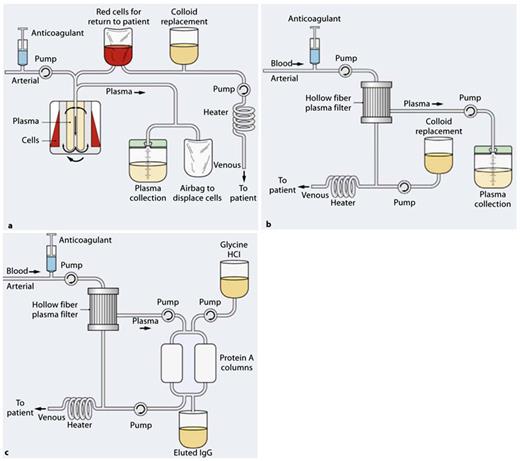 Plasmapheresis in Immunologic Renal Disease | Blood Purification ...