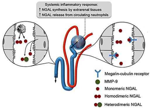 The Rise and Fall of NGAL in Acute Kidney Injury | Blood Purification ...
