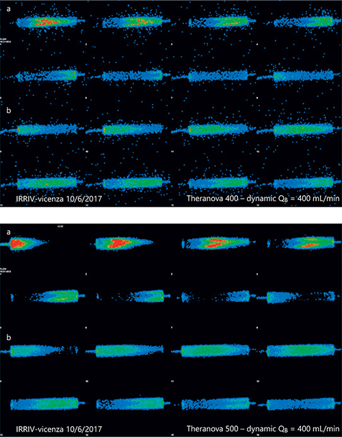 Quantification of Internal Filtration in Hollow Fiber Hemodialyzers ...