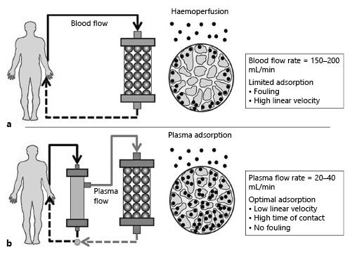 Coupled Plasma Filtration Adsorption: A Multipurpose Extracorporeal ...