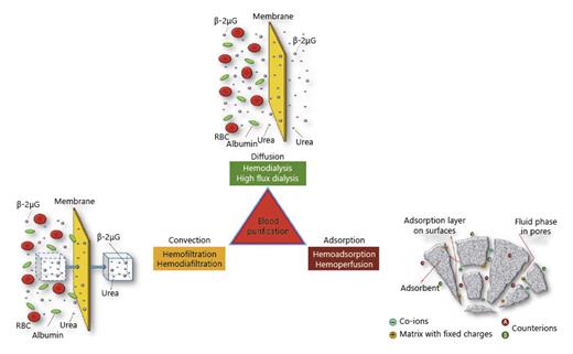The Promise of Adsorption for Chronic Dialysis Patients | Blood ...