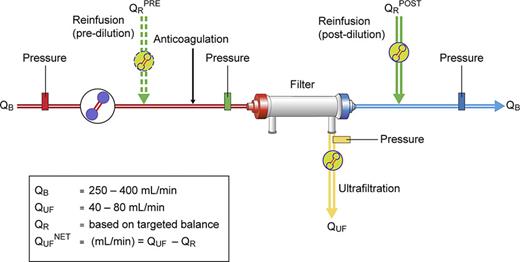Extracorporeal Techniques in Kidney Failure | Blood Purification ...