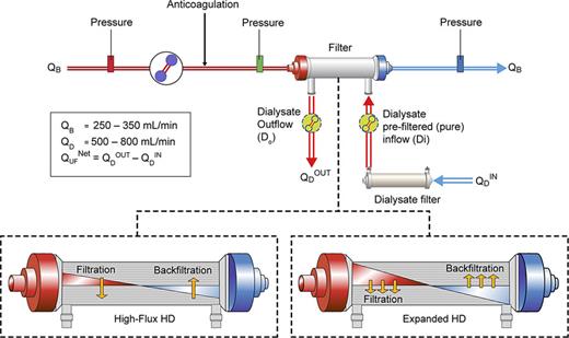 Extracorporeal Techniques in Kidney Failure | Blood Purification ...