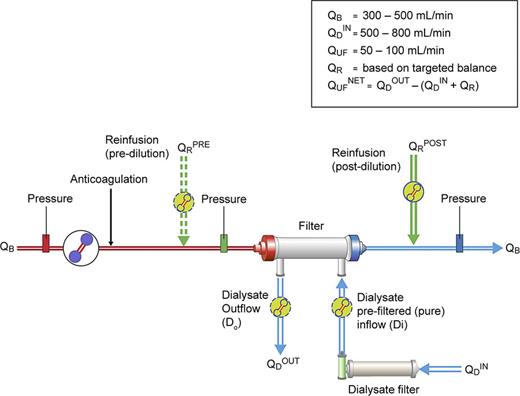 Extracorporeal Techniques in Kidney Failure | Blood Purification ...