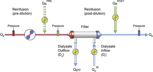Nomenclature of Extracorporeal Blood Purification Therapies for Acute ...