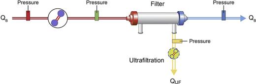 Nomenclature of Extracorporeal Blood Purification Therapies for Acute ...
