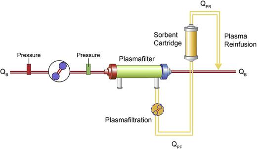 Nomenclature of Extracorporeal Blood Purification Therapies for Acute ...