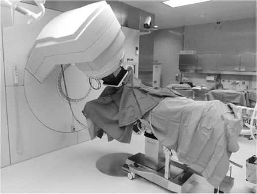 Intraoperative Electron Radiotherapy (IOERT) in the Treatment of ...