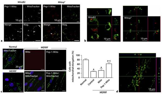 Functional Recovery of Human Cells Harbouring the Mitochondrial DNA ...