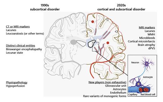 Cerebral Small-Vessel Diseases: A Look Back from 1991 to Today ...
