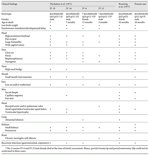 Familial Translocation t(6;20)(p21;p13) Resulting in Partial Trisomy 6p ...