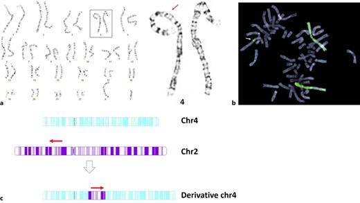 Large Chromosome 2p Duplication-Associated Mechanisms and Clinical ...