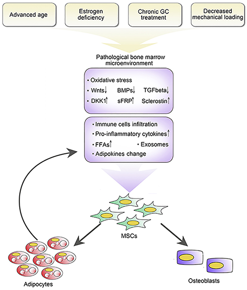 Osteoblast versus Adipocyte: Bone Marrow Microenvironment-Guided ...
