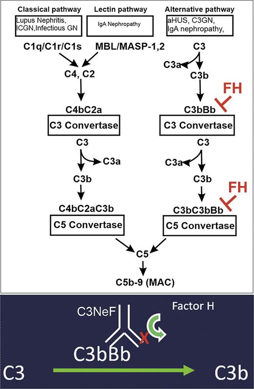 Complete Renal Recovery in Pediatric Patient with C3 Glomerulonephritis ...
