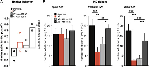 Cochlear NMDA Receptors as a Therapeutic Target of Noise-Induced ...