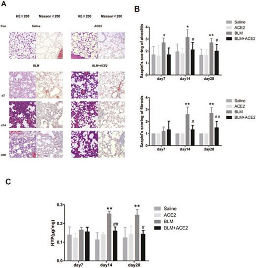 Angiotensin-Converting Enzyme 2 Attenuates Bleomycin-Induced Lung ...