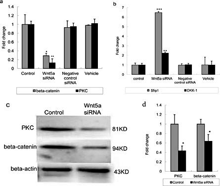 Wnt/β-Catenin and Wnt5a/Ca2+ Pathways Regulate Proliferation and ...