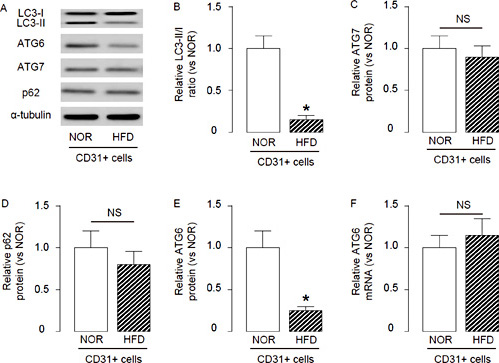 Endothelial Cell Autophagy in Atherosclerosis is Regulated by miR-30 ...