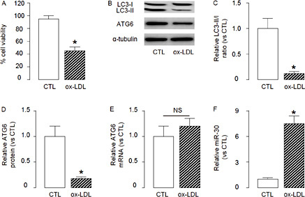 Endothelial Cell Autophagy in Atherosclerosis is Regulated by miR-30 ...